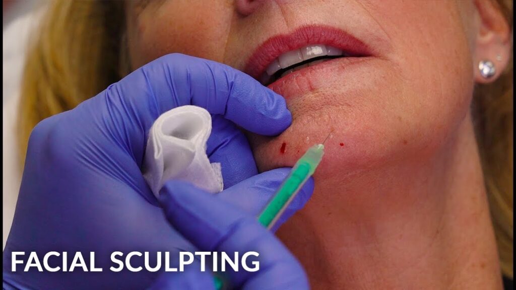 Facial Sculpting - Cosmetic Dermatologist Dr. Jason Emer