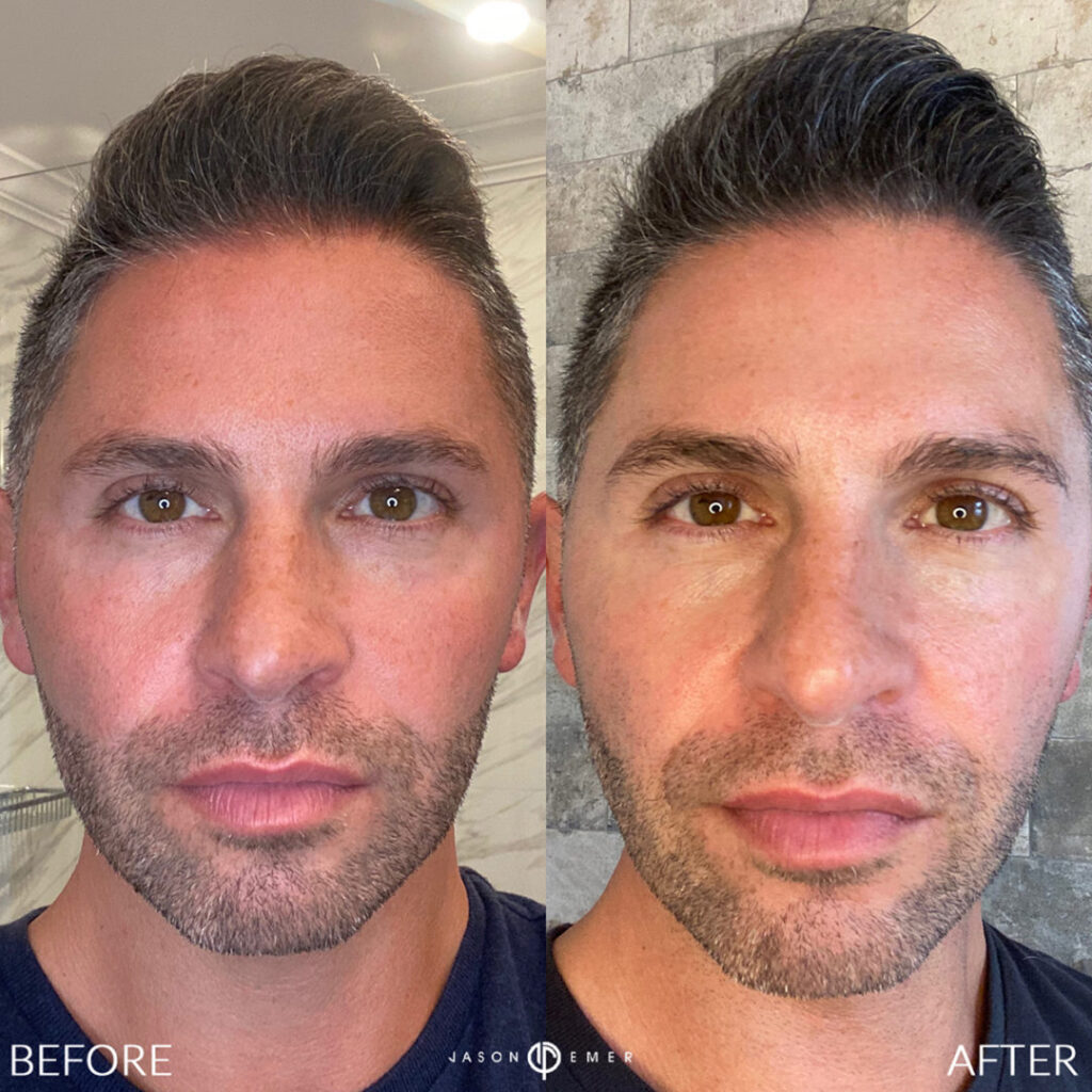 Aerify Kit - Cosmetic Dermatologist Dr. Jason Emer